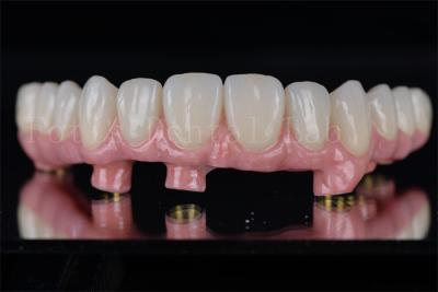 China All on 4 All on 6 Dental Implants Full Arch Zirconia Bridge Restores Chewing for sale