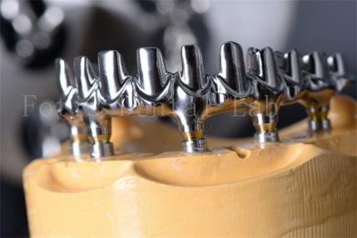 China All on 4 All on 6 Dental Implants Titanium Zirconia Full Arch No Age Limit for sale