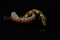 China Titanium Zirconia All on 4 All on 6 Dental Implants Full Arch Bridge Lifetime Warranty for sale