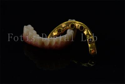 China Titanium Zirconia All on 4 All on 6 Dental Implants Full Arch Bridge Lifetime Warranty for sale