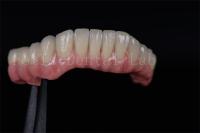 China All on 4 All on 6 Zirconia Titanium Dental Implants Full Arch Customized 4 or 6 Implants for sale