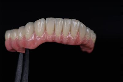 China All on 4 All on 6 Zirconia Titanium Dental Implants Full Arch Customized 4 or 6 Implants for sale