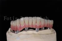 China All on 4 All on 6 Implant Dentures Titanium Zirconia Full Bridge Restoration for sale