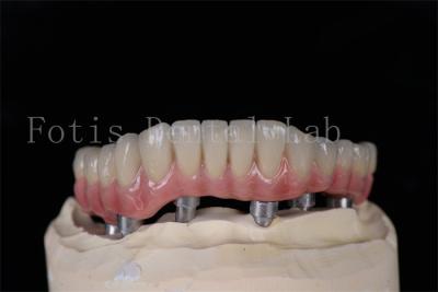 China All on 4 All on 6 Implant Dentures Titanium Zirconia Full Bridge Restoration for sale