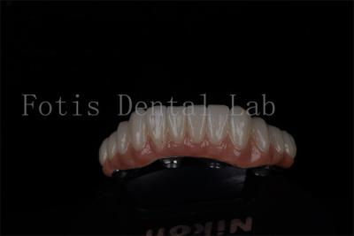 China All on 4 All on 6 Full Arch Implants Titanium or Zirconia High Success Rate 4 or 6 Implants for sale