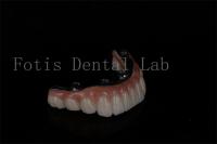 China No Age Limit Affordable All On 6 Zirconia Implants Easy Maintenance for sale