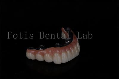 China No Age Limit Affordable All On 6 Zirconia Implants Easy Maintenance for sale