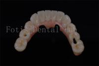 China Natural Looking All On Four Teeth In A Day For Any Age Available for sale