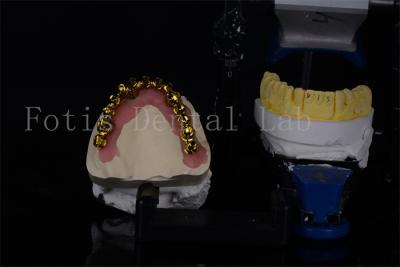 China All on 4 All on 6 Dental Implants Titanium Zirconia Full Arch Bridge for sale