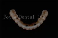China Replacement All On 4 All On 6 Advanced Dental Implants For Optimal Functionality for sale