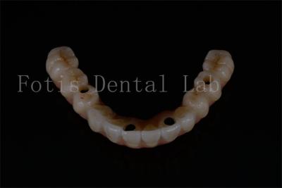 China Replacement All On 4 All On 6 Advanced Dental Implants For Optimal Functionality for sale