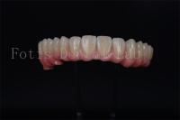 China Full Arch All on 4 All on 6 Dental Implant Bridge for Complete Mouth Restoration for sale