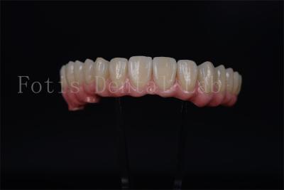China Full Arch All on 4 All on 6 Dental Implant Bridge for Complete Mouth Restoration for sale
