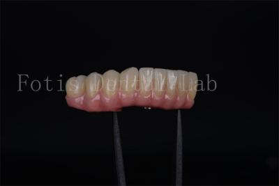China All on 4 All on 6 Dental Implant System Same Day Teeth Replacement 4 or 6 Implants for sale