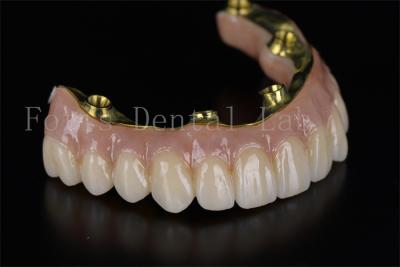China All on 4 All on 6 Dental Implant System Full Arch Restoration Same Day Teeth for sale