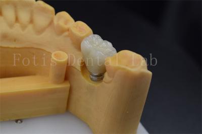 China Zirconia Implant Crown Polished Surface High Precision Fit for Dental Restoration for sale