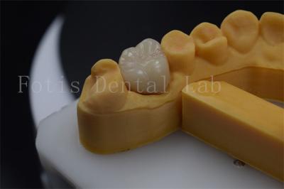 China Titanium / PFM Denture Crown Customizable Zirconia Implant Crown Durable for sale