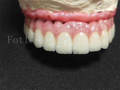 China Zirconia Implant Crown Polished Finish Dental Prosthetic Crown for Missing Tooth Restoration for sale
