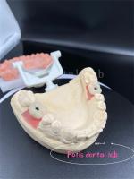 China Custom Zirconia Implant Crowns for Dental Restoration Precision Fit Silver 1 Piece for sale