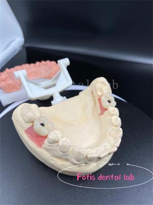 China Custom Zirconia Implant Crowns for Dental Restoration Precision Fit Silver 1 Piece for sale