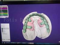 China Tooth Restoration Denture Design Studio Expertly Crafted For Your Satisfaction for sale