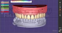China Dental Design Suite for Prosthesis Planning and Oral Implant Design with Smile Simulation for sale