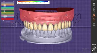 China Dental Design Suite for Prosthesis Planning and Oral Implant Design with Smile Simulation for sale