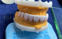 China FDA ISO CE Certified Digital Dental Crowns Bridge Framework Dentures 1 Day Turnaround for sale