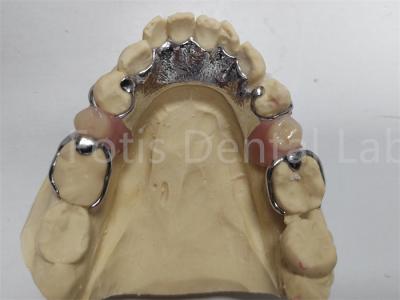 China Customizable Co Cr Partial Denture Removable Dental Prosthesis for Missing Teeth for sale