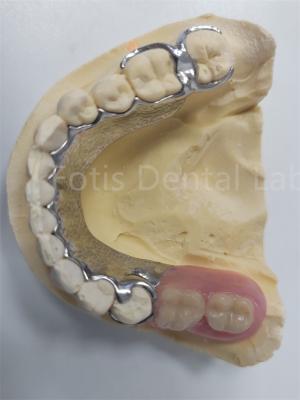 China Removable Partial Denture Flexible Design Replace Missing Teeth Co Cr PEEK for sale