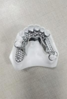 China Customizable Removable Partial Denture Flexible Co Cr Peek Easy Clean Stable Fit for sale