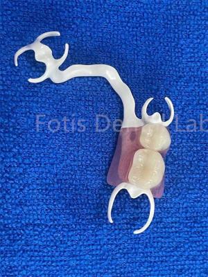 China Customizable PEEK Removable Partial Denture for Stable Teeth Replacement for sale