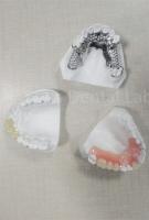 China Customizable Co Cr Removable Partial Denture for Replacing Missing Teeth Durable and Adjustable for sale
