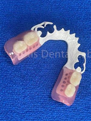 China Customizable Co Cr Removable Partial Denture Flexible Stable Dental Prosthesis for sale