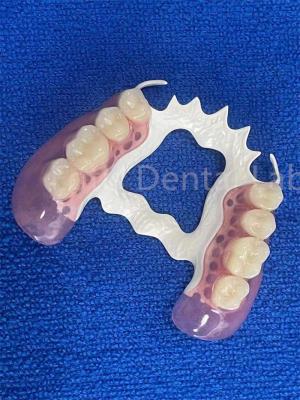 China Customizable Removable Partial Denture Co Cr PEEK Stable Replace Missing Teeth Prosthesis for sale