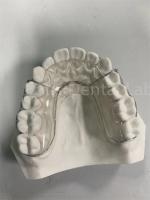 China Orthodontic Retainer Expander One Size Fits All Safe Durable Teeth Retention Solution for sale