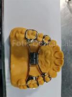 China Hygienic Orthodontic Expander Easy To Clean Dental Teeth Retainer Adjustable Design for sale