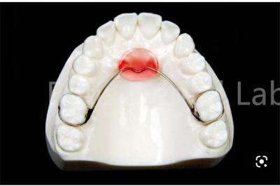 China Adjustable Mouth Expanding Retainer For Safe Teeth Retention And Expansion for sale