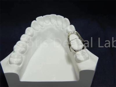 China Adjustable Orthodontic Retainer Expander One Size Fits All for Teeth Retention and Expansion for sale