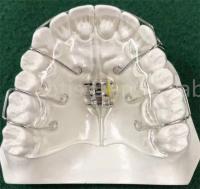 China Customizable Orthodontic Expanding Retainer Medical Grade BPA Free Thermoplastic for Dental Therapy for sale