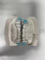 China Professional  Comfortable Fit Retainer Expander Orthodontic Correction Device for sale