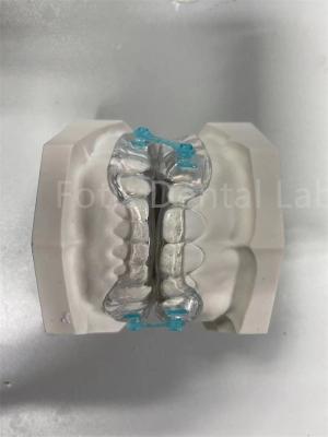 China Professional  Comfortable Fit Retainer Expander Orthodontic Correction Device for sale