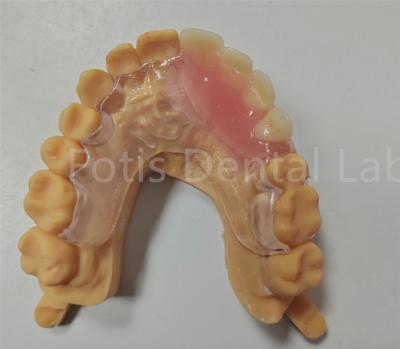 China Hypoallergenic Flexible Valplast Partial Denture TCS Comfort Fit Stain Resistant for sale
