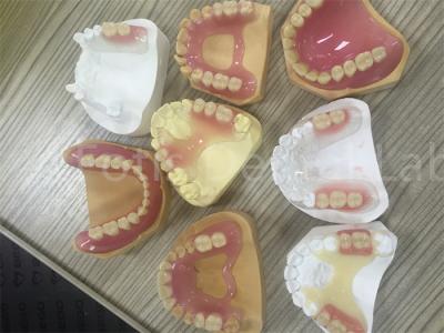 China TCS Valplast Flexible Removable Partial Denture Pink Transparent 1 Pair Easy Adjust for sale