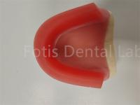 China FDA Approved Red Glossy Bite Rims for Occlusal Relation Upper or Lower for sale