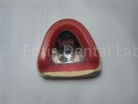 China Red Glossy Denture Wax Bite Rims Occlusal Contour Rim for Dental Prosthetics for sale