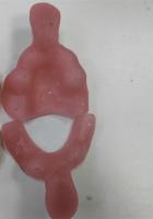 China Customizable Dental Bleaching Tray Any Color At Home Whitening Trays Upper or Lower for sale