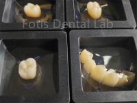 China Zirconia Multilayer Dental Restoration Block 98mm High Fracture Resistance CADCAM for sale