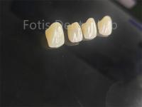 China Full Contour Porcelain Zirconia Crown Bridge Dental Restoration 900 MPa Flexural Strength for sale