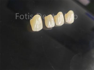 China Full Contour Porcelain Zirconia Crown Bridge Dental Restoration 900 MPa Flexural Strength for sale